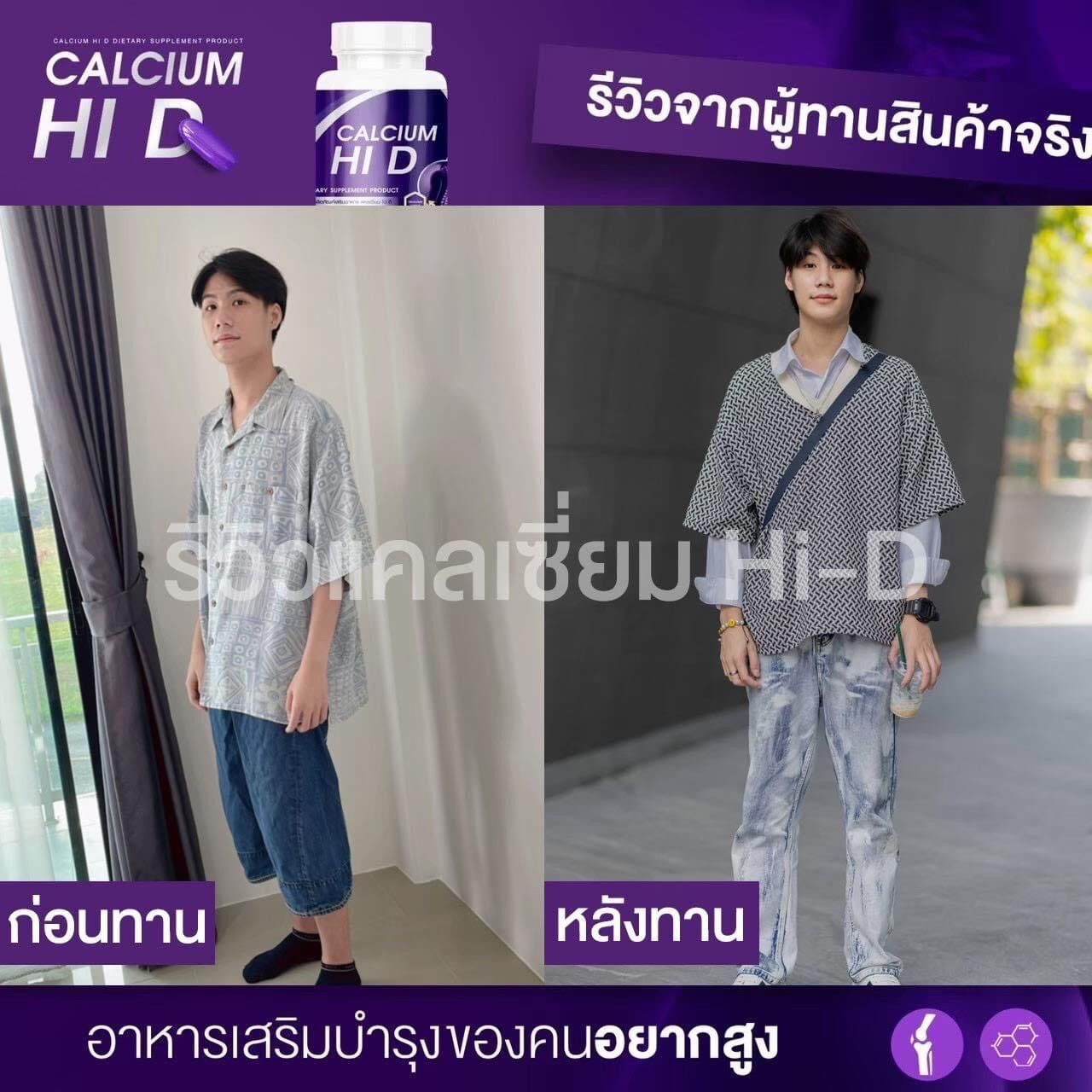 Hid แคลเซียม ไฮดี 1แถม1 Hi-D Calcium วิตามิน 1 กระปุก 20 แคปซูล พร้อม ...