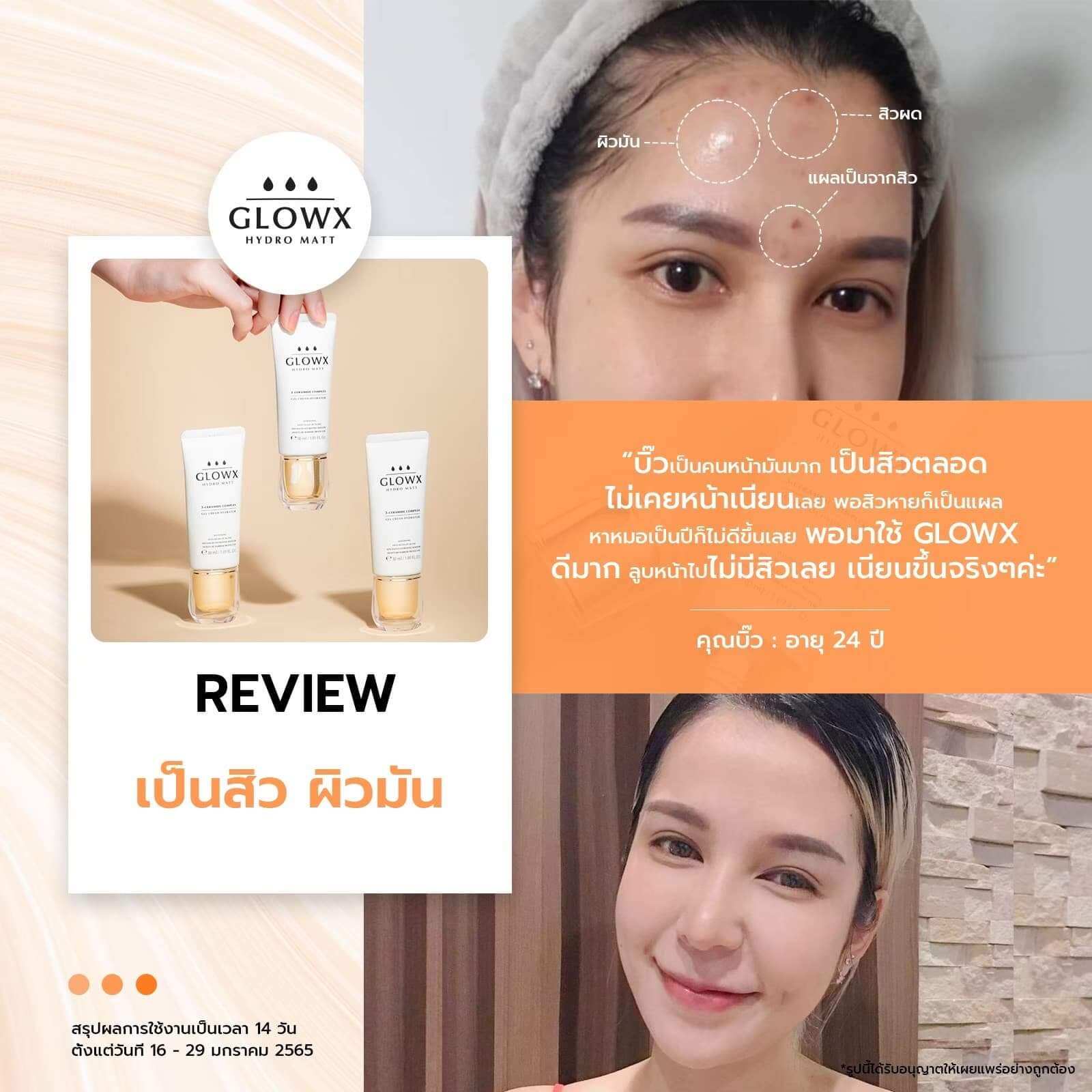 ครีมบำรุงผิวหน้าGLOWXขนาด30ml.เป็นสิวผิวมัน - บีแอนด์อีShop - ThaiPick