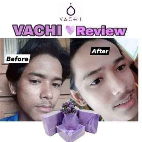 VaChi မ်က္ႏွာသစ္ေလးက. ေရးဓာတ္ျဖည့္ေပးတယ္ မ်က္ႏွာအသားျဖဴျမန္တယ္ တင္းတိပ္ ...