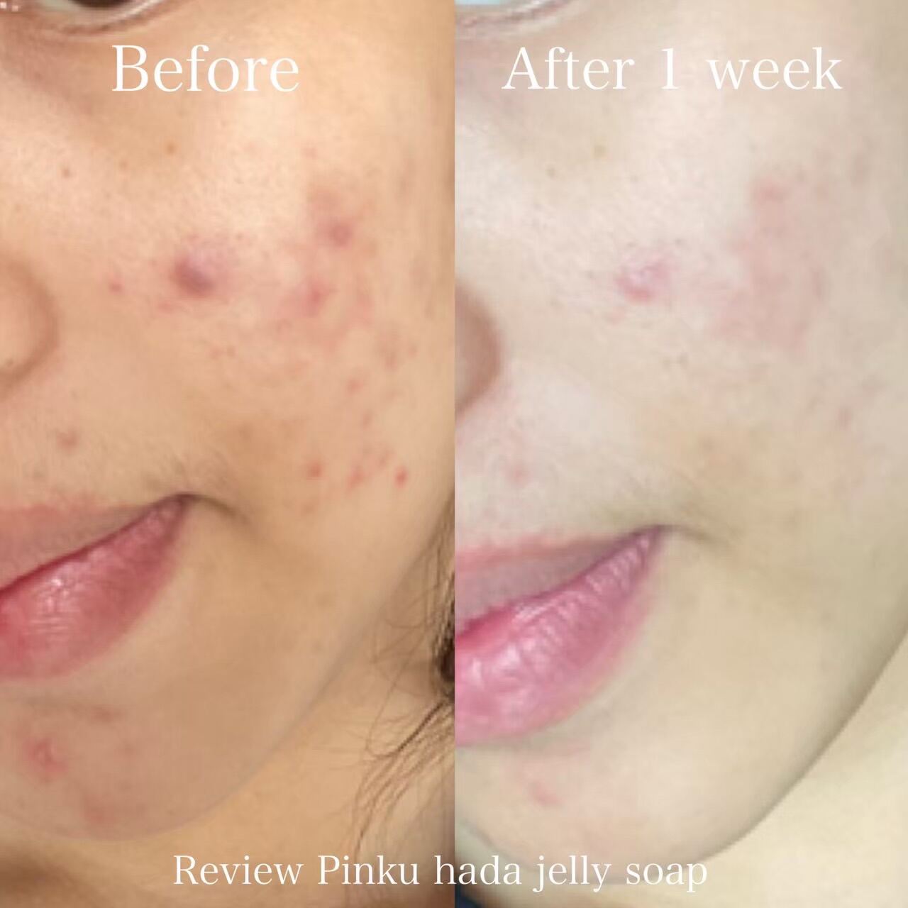(พร้อมส่งมีCOD) Pinku hada jelly soap - พลอยน้อยสกินดี - ThaiPick
