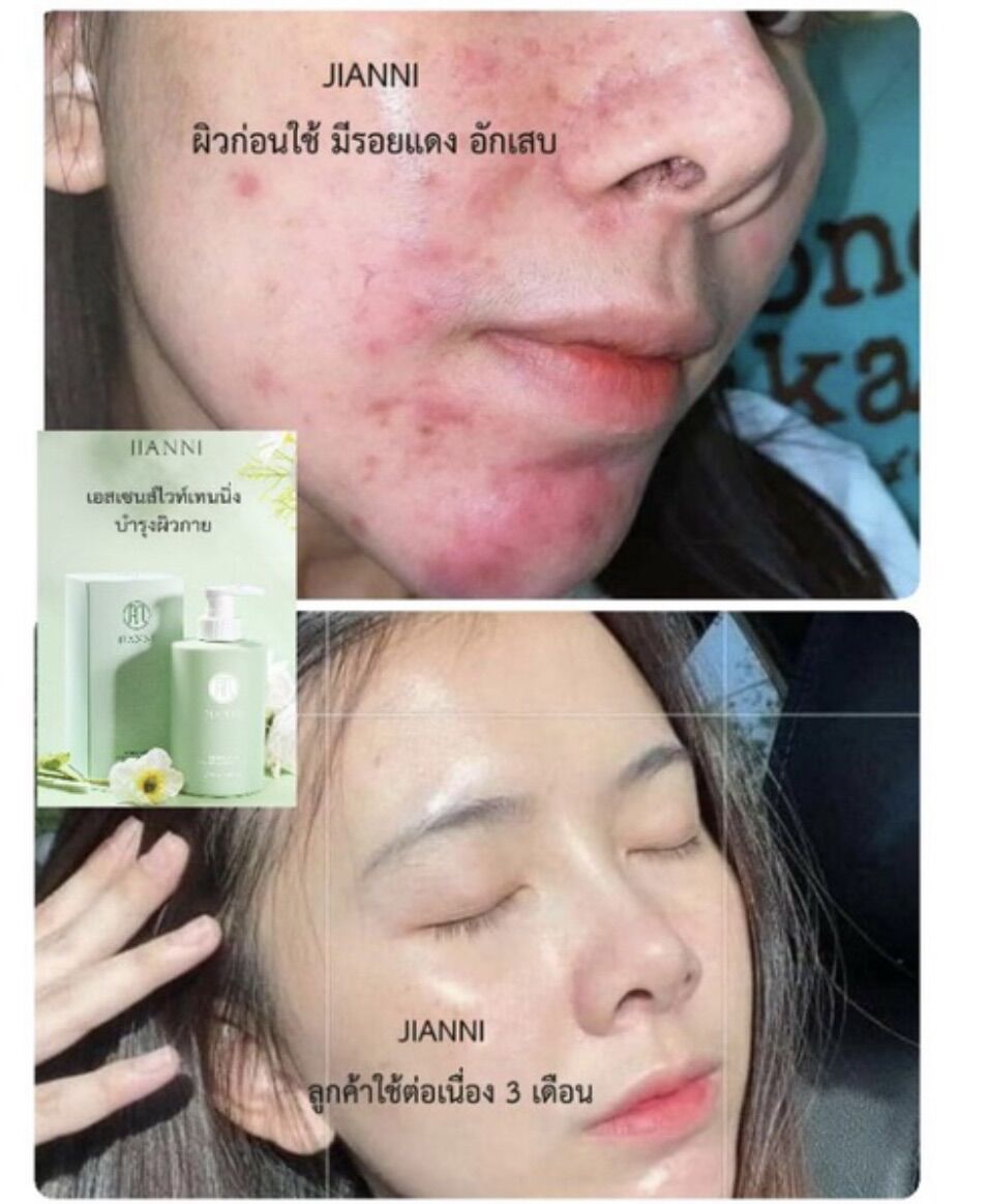 โลชั่นบำรุงผิวขาว #Jianni ????เอสเซนส์ไวท์เทนนิ่ง ????สูตรเร่งขาวเร็ว ...
