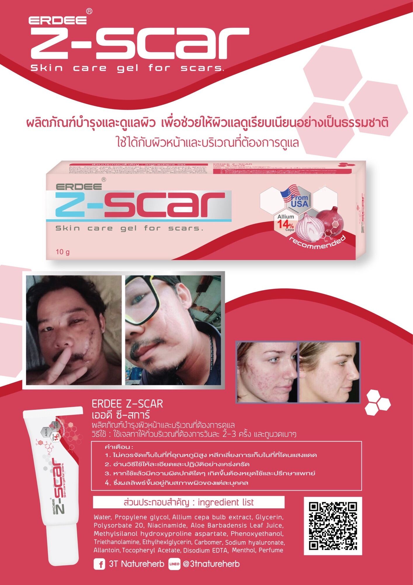 เจลลดแผลเป็น Z-scar skin care gel from USA แผลเป็นนูน จุดด่างดำ แผลไฟ ...