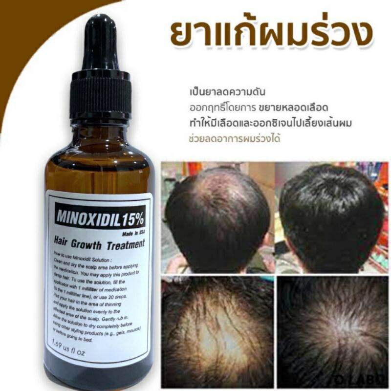 Hair loss solution 15 Minoxi - Good Hair 888 - ThaiPick