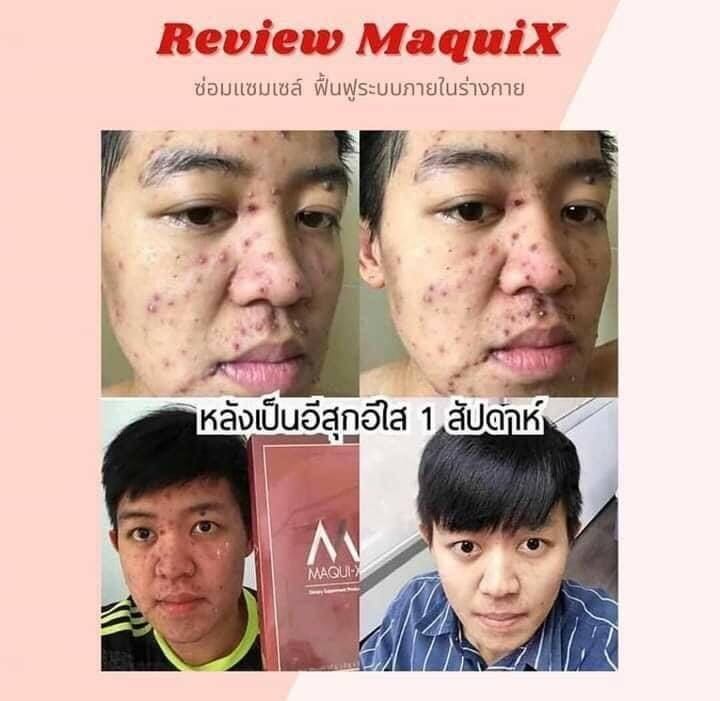 Maqui-X(มากิ-มาเอ็กซ์)เพิ่มคอลลาเจน เร่งระบบเผาผลาญ บำรุงผิวพรรณ สายตา ...