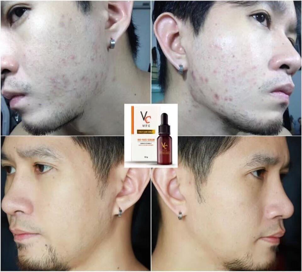 VC Vit C Bio face Serum (10 ml.)เซรั่มวิตซีน้องฉัตร - Me n me 56 - ThaiPick