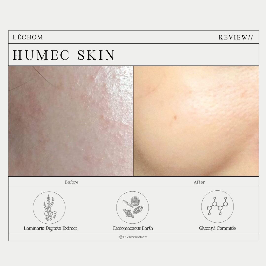 (ล็อตสุดท้าย มีของแถม) ️ฮิวเมคสกินมอยส์เจอร์ไรเซอร์ (humec skin) พร้อม ...