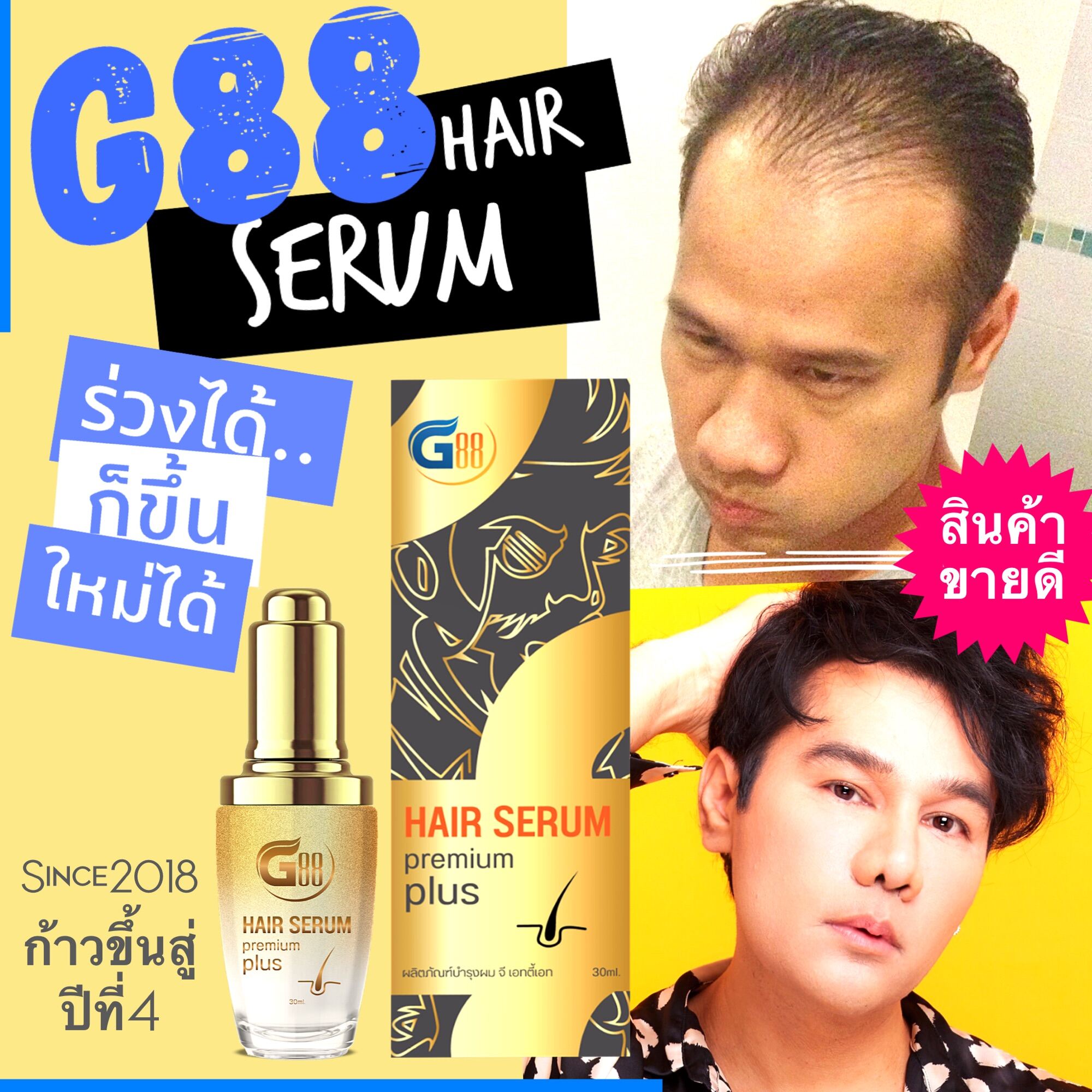 Best Set G88 hair serum plus G88 shampoo (ของแท้) ลดผมร่วง ปลูกผม - G88 HAIR SERUM - ThaiPick