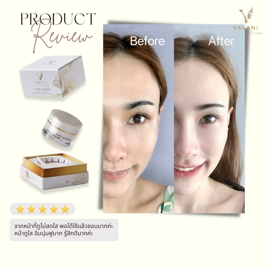 VALANI FINOL CREAM ANTI - AGING ANTI - WRINKLE ครีมย้อนวัยผิว อ่อนเยาว์ ...