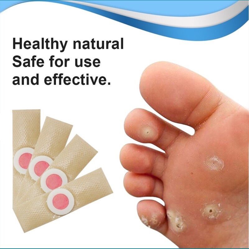 12ชิ้นกล่อง พลาสเตอร์แผ่นแปะตาปลา พลาสเตอร์แปะหูด แปะแน่น หลุดง่าย ใช้ ...