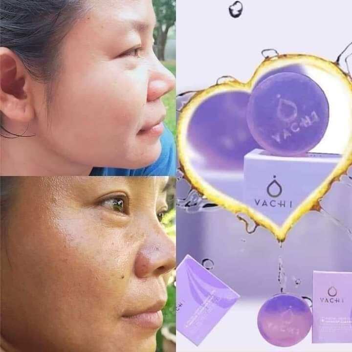 မ်က္ႏွာသစ္ဆပ္ျပာေကာင္းေကာင္းေလး႐ွာေနရင္ Vachi ေလးကိုသံုးၾကည့္ေနာ္ ...