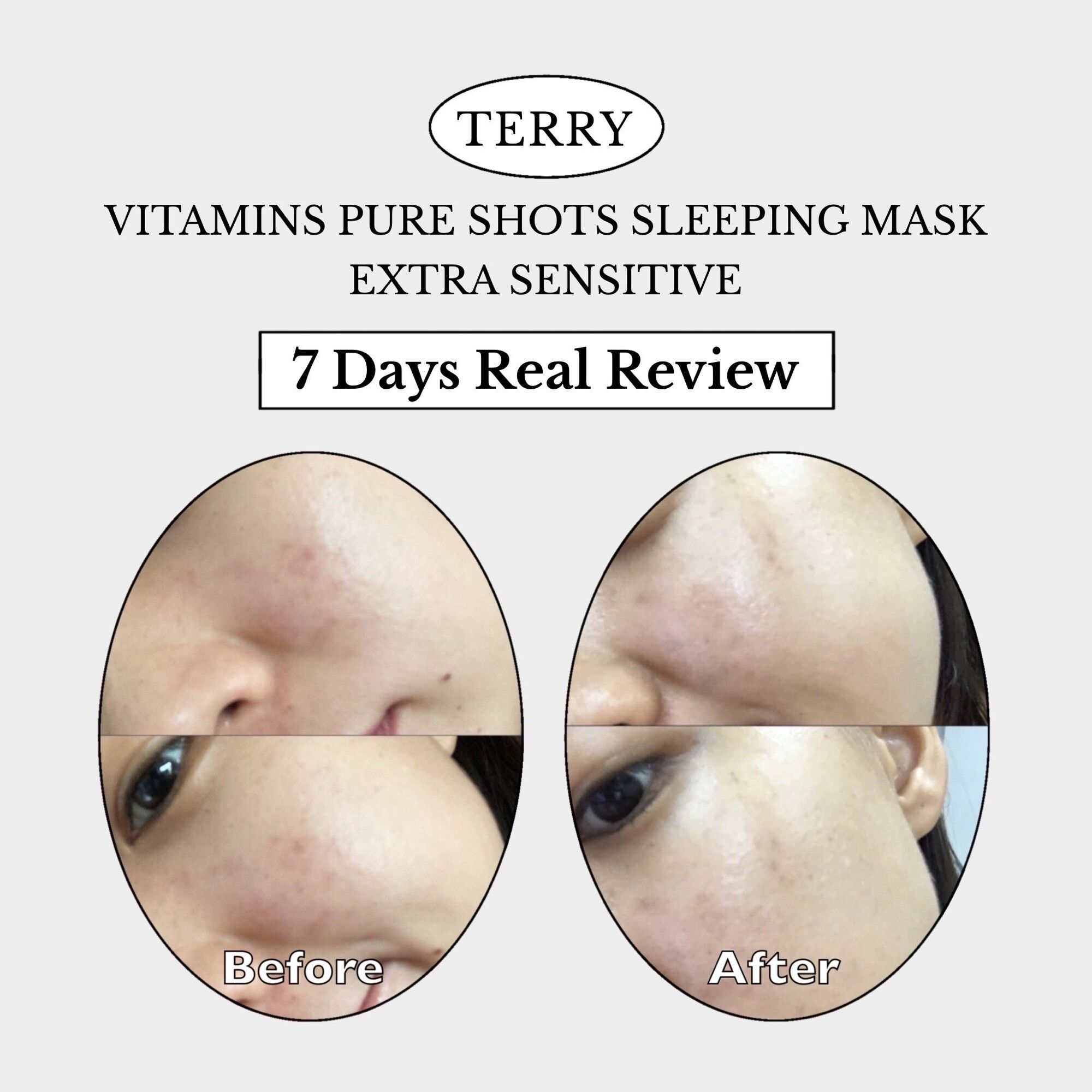 ( 1 แถม 1ส่งฟรี) เธอรี่สลิปปิ้งมาส์ก (New Terry Sleeping Mask) ของแท้ ...