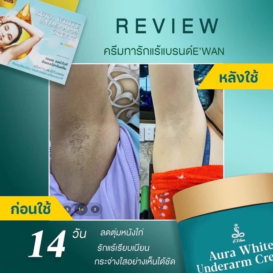 Ewan aura white underarm creamอีวรรณครีมรักแร้ขาวลดตุ่มหนังไก่ (4 กป) - Ok naka - ThaiPick