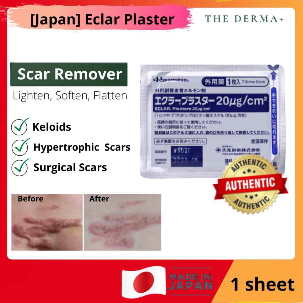 Japan Scar Removal Keloid Treatment - Hisamitsu Eclar Plaster ...