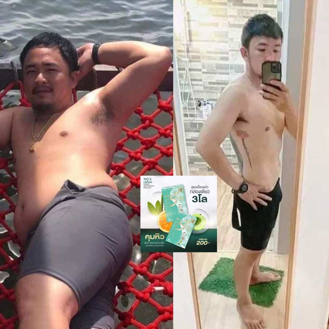 NQ s cross ของแท้100 10 แคปซูล คุมหิว อิ่มนาน เผาผลาญ x10 - 5mhPd4Ny - ThaiPick