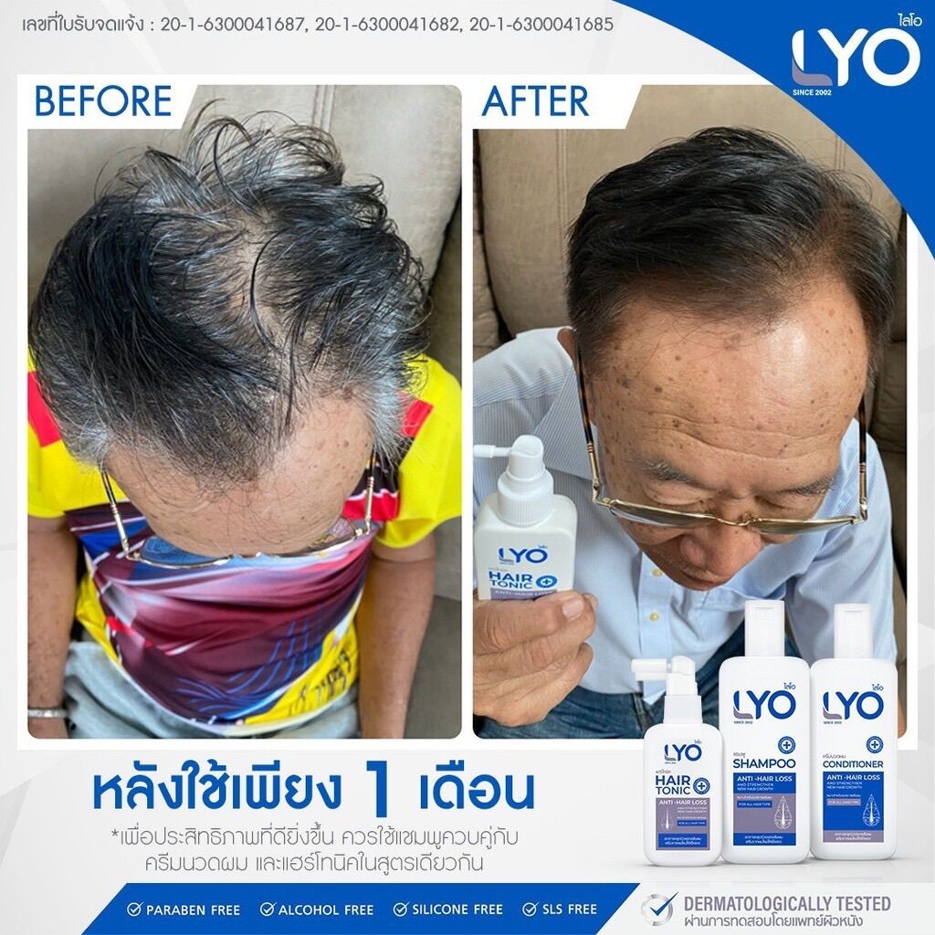lyo แตกปลาย หงอก ร่วง !!!! lyo ไลโอ ผลิตภัณฑ์เพื่อเส้นผม Set 3ขวด แฮร์ ...