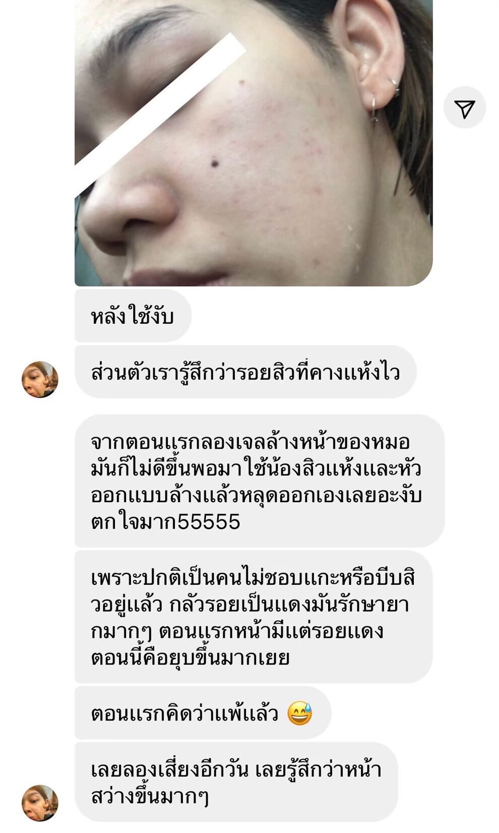 (พร้อมส่งมีCOD) Pinku hada jelly soap - พลอยน้อยสกินดี - ThaiPick