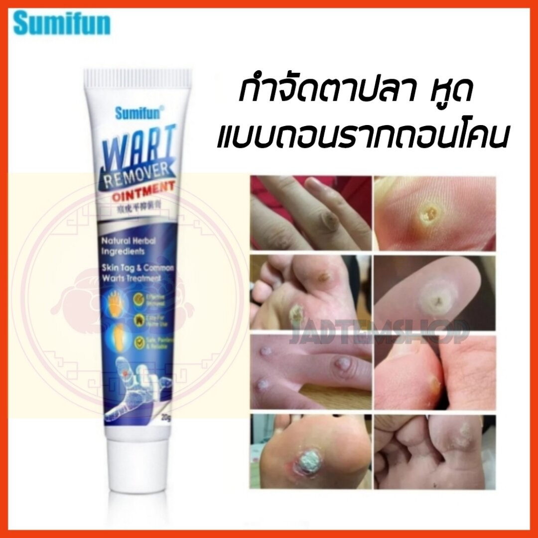 Warts Remover Freckle Face Wart Tag (ขี้แมลงวันลอกหูดตาปลาช่วยให้หูด ...