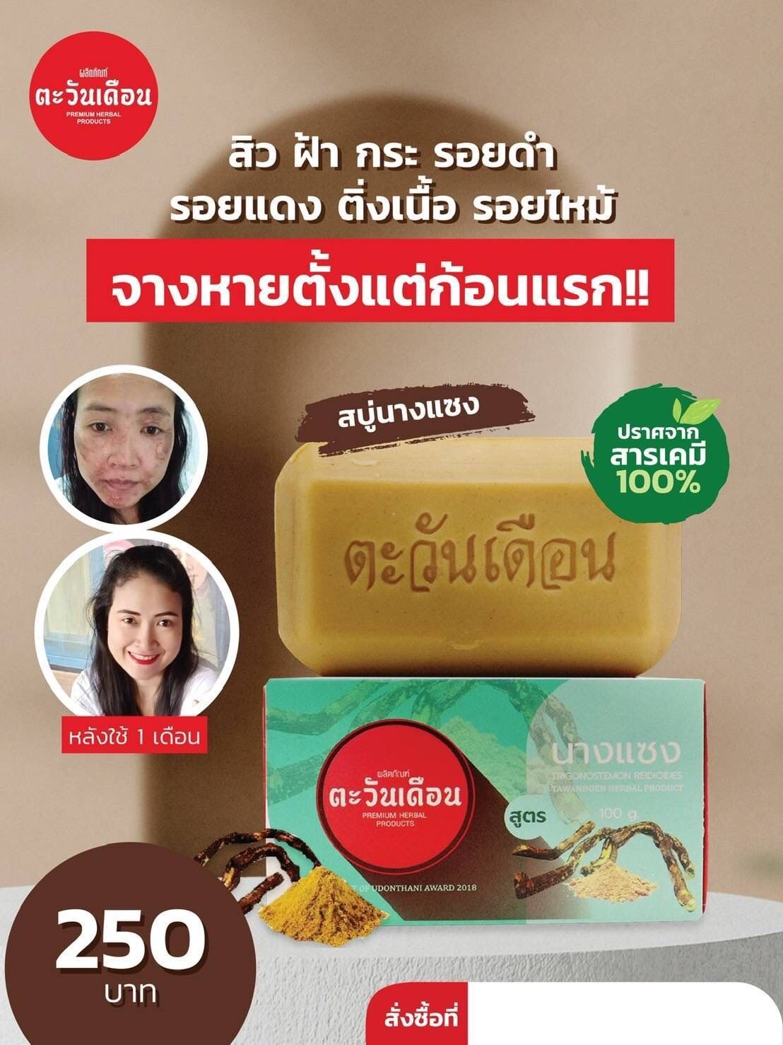 สบู่สมุนไพรรักษา สิว ฝ้าแดด กระเนื้อ ติ่งเนื้อ (Official Store) | Lazada.co.th