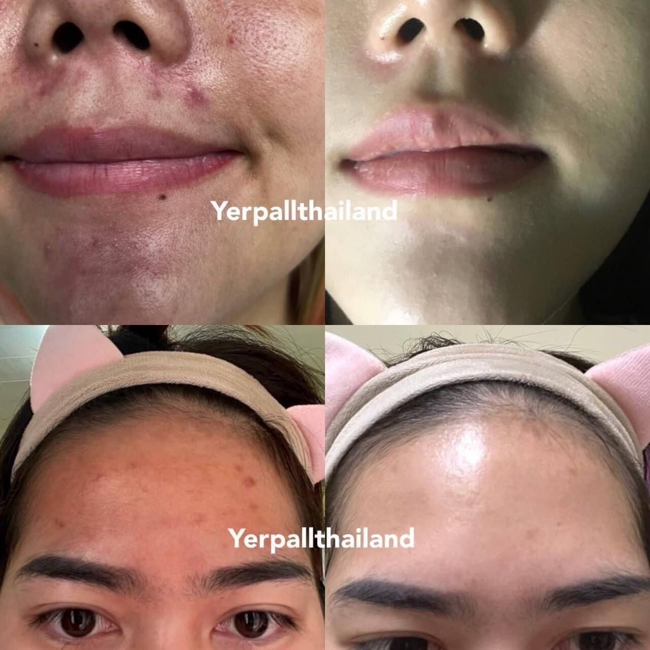 #มาร์คหน้าสด แบรนด์ Yerpall - Skincare by Peach - ThaiPick