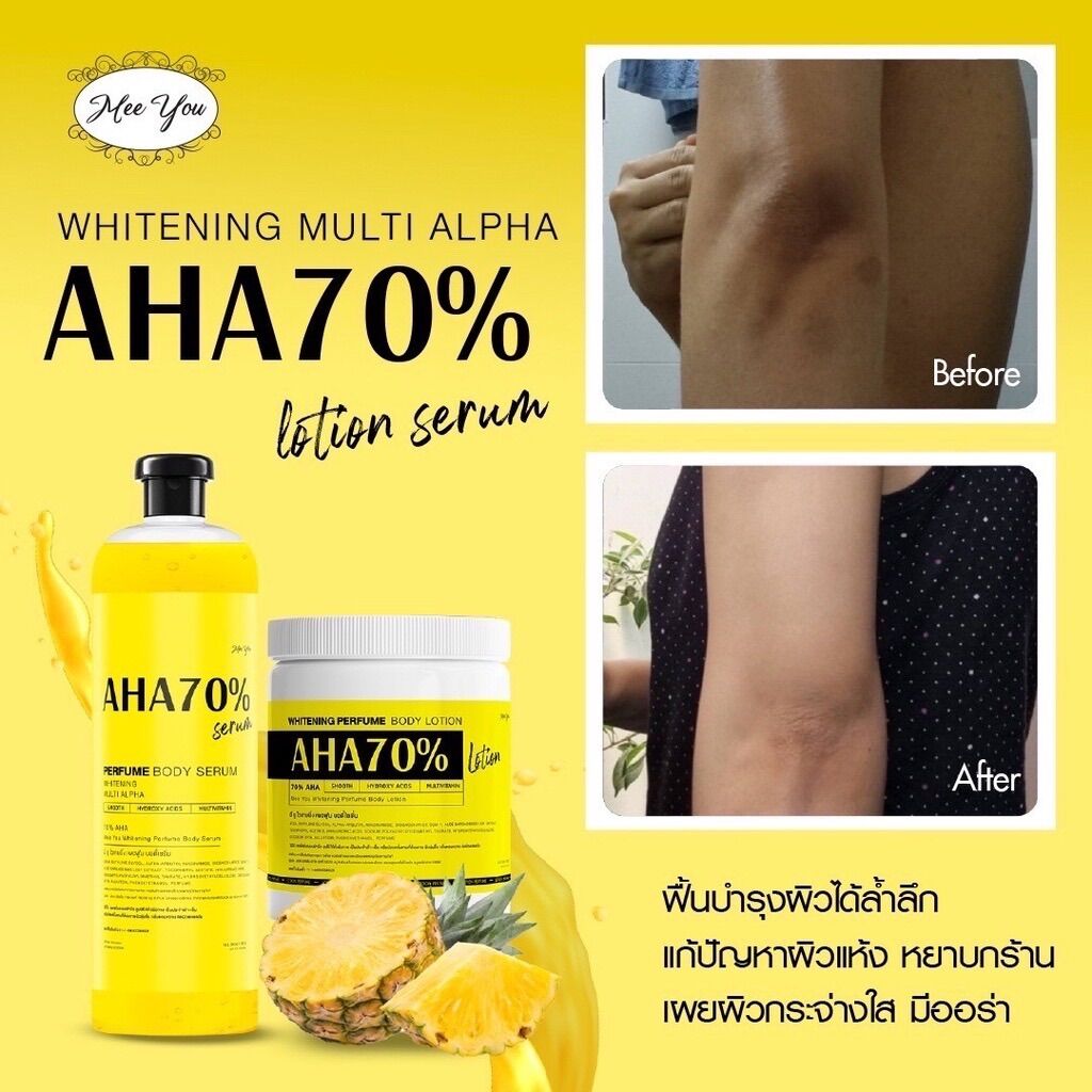 คุ้มมาก????เซ็ตคู่ขาว AHA Whitening Multi Alpha 2ni1 - Beauty_Beauty ...