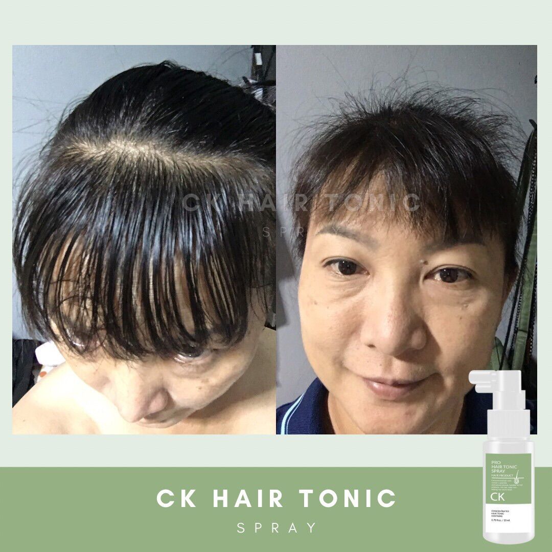 CK Pro Hair Tonic Spray 20ml ???? โทนิค ซีเคส เปรย์ฉีดผม ลดผมร่วงฟื้นผม ...