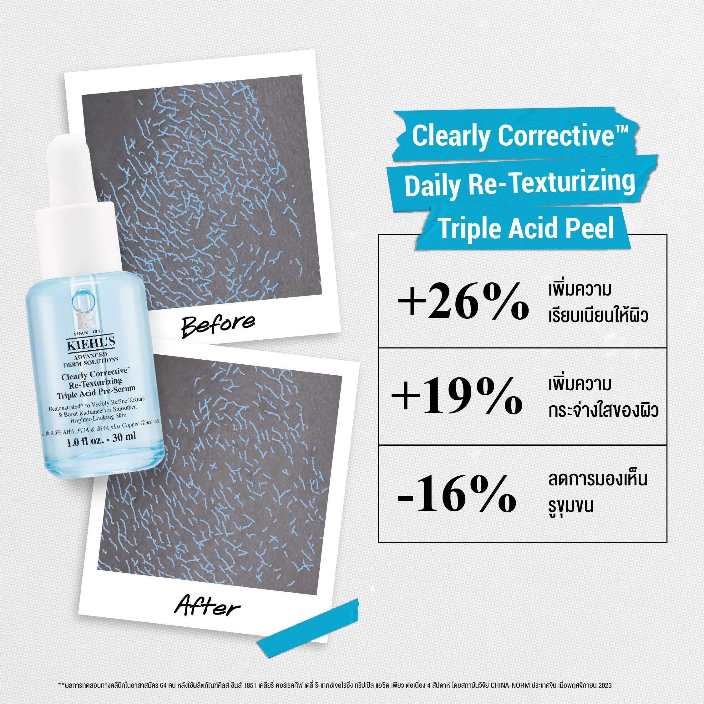 NEW Kiehls Clearly Corrective Daily Re-Texturizing Triple Acid Peel ...