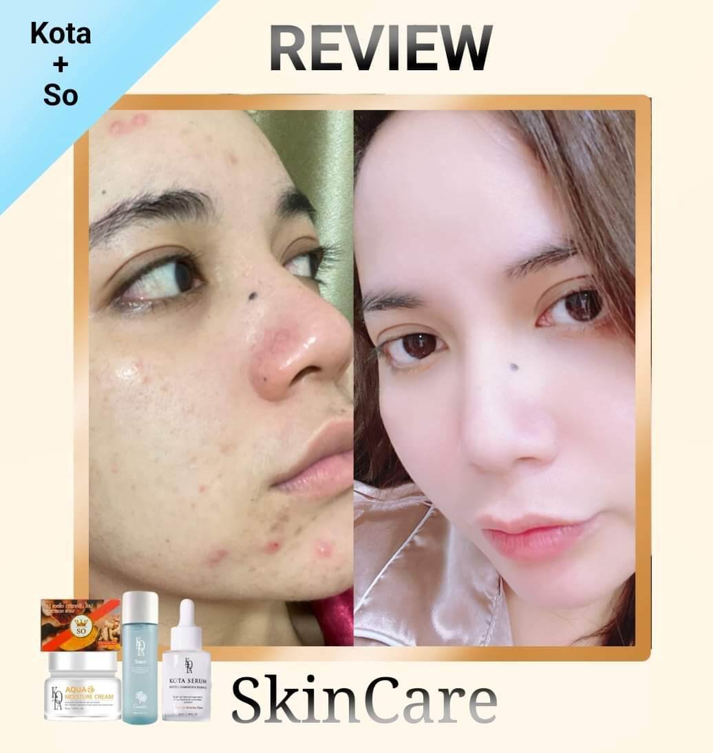 Shop online with Ma Ma Soe Cosmetics Shop ️ ️ ️ now! Visit Ma Ma Soe Cosmetics Shop ️ ️ ️ on Lazada.