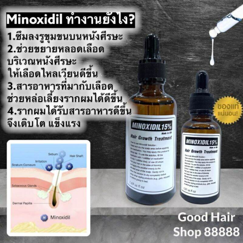 Hair loss solution 15 Minoxi - Good Hair 888 - ThaiPick