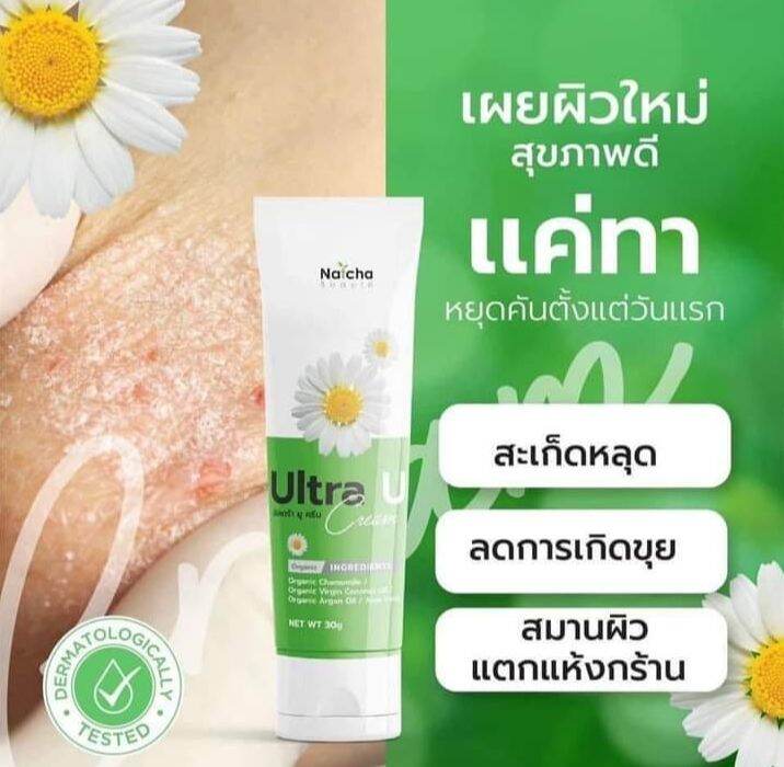 ครีมแก้ปัญหาเชื้อรา อัลตร้ายู ครีม Natcha Ultra U Cream คัน กลากเกลื้อน สะเก็ดเงิน 30g | Lazada ...